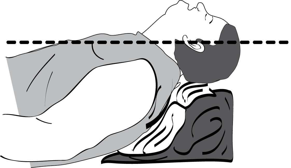 Factors That Make Emergency Intubation Difficult and the RSI Sequence ...
